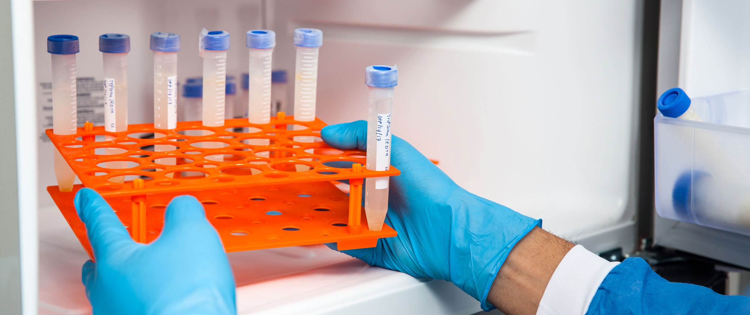 Quality Control Using Blood Temperature Indicators